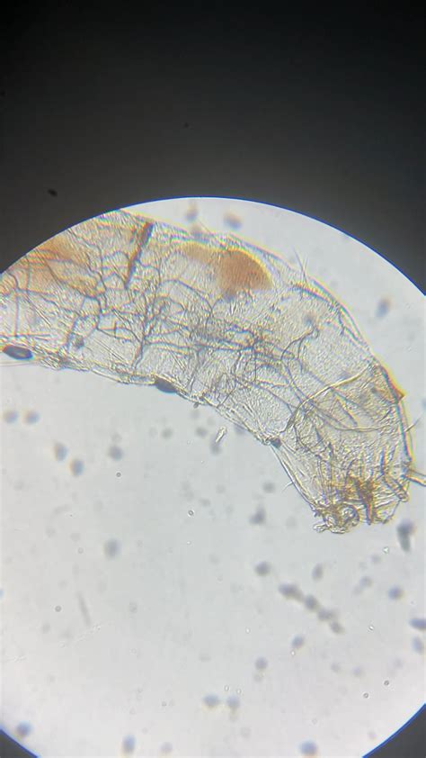A Flea Larvae R Microscopy