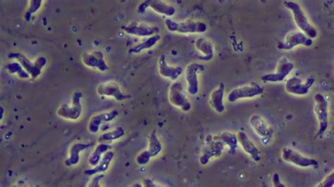Amoeba Causes Disease That Spreads In Unconventional Way Fox News