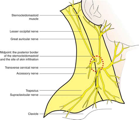 Lumbar Plexus Block Landmark Technique Psoas Compartment Block