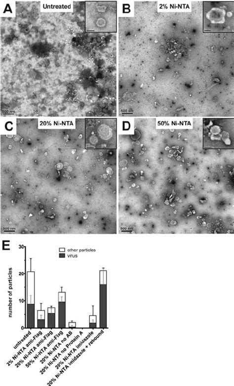 Cryo Electron Microscopy ~ Cryo Em Images And Cryoelectron Tomography