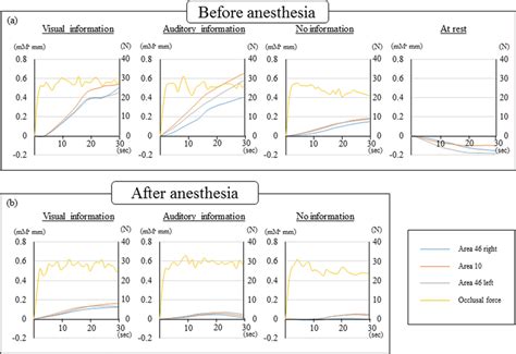 A Typical Temporal Patterns Of Cbf And Occlusal Force Before Local