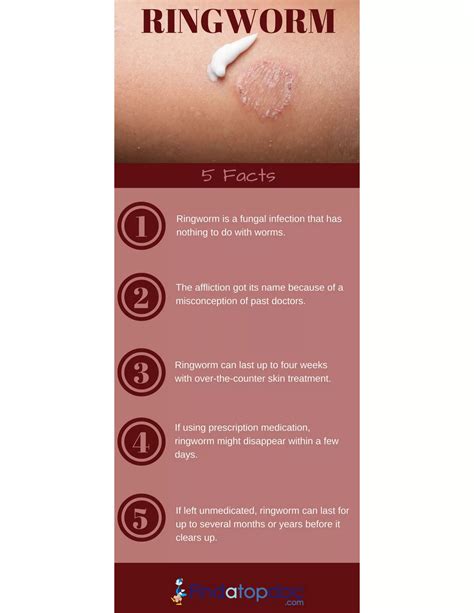 Facts About Ringworm Pdf