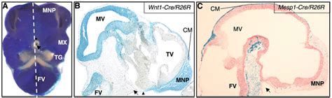 Neural Crest And Mesodermal Contributions To The E105 Cranial Base Of
