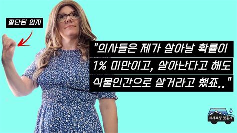 인터뷰 심장수술 의료사고로 3주 넘게 혼수상태 죽음에서 돌아온 5남매 엄마의 이야기를 들어보았습니다 Youtube
