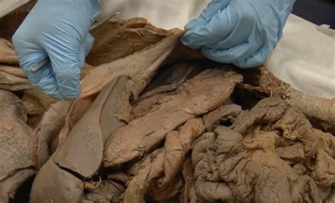 Digestive System And Respiratoy Cadaver Flashcards Quizlet