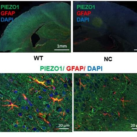 Neuronal Sensitivity To Ultrasound Stimulation Depends On The Expression Of Download