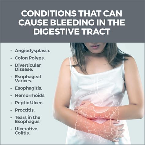 Upper Gi Bleed Gi Bleeds Trialquest Inc