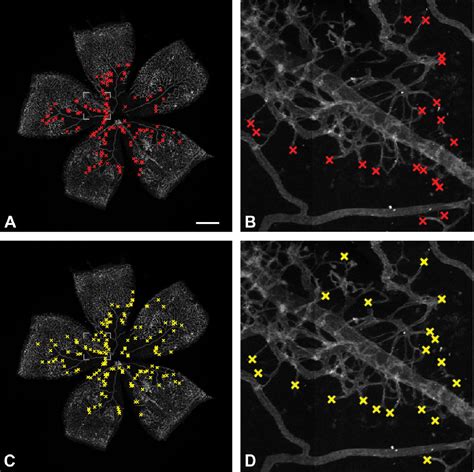 Figure 2 From Deep Learningbased Detection Of Endothelial Tip Cells In The Oxygen Induced