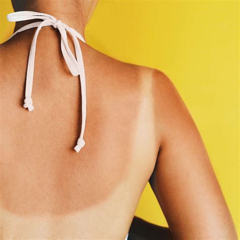 Tan Lines Are Back In Fashion But Can You Get The Look Safely Bbc News