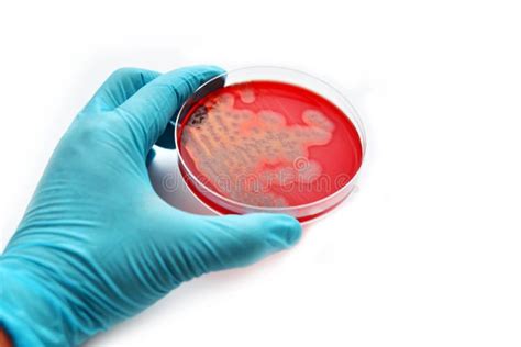 Bacteria Colonies Stock Image Image Of Laboratory Gonorrhoeae 98247475