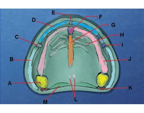 Maxillary Intraoral Landmarks Of Edentulous Quiz