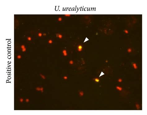 Direct Fluorescence Assay Dfa Staining For The Detection Of C