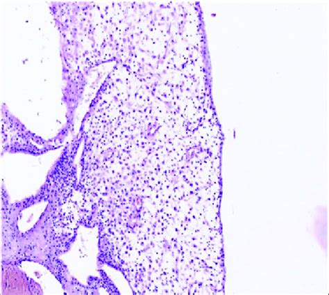 Weak Decidualization Of The Stroma Of The Parietal Endometrium With Download Scientific Diagram