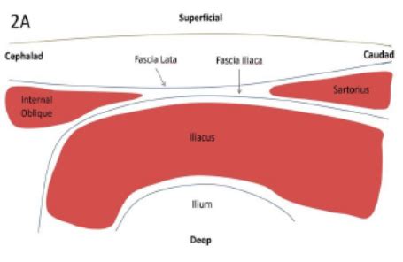 Fascia Iliaca Block Kwak Talk