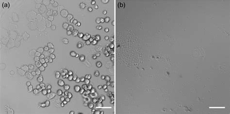 Figure F1 Microscopic Inspection Of Well Plate After Cell Detachment