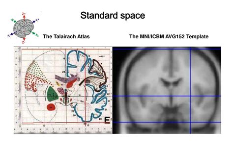 Ppt Spatial Preprocessing Of Fmri Data Powerpoint Presentation Free