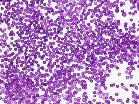 Synthesis Of Highly Monodispersed Agarose Microcapsules Fluigent