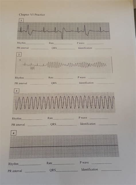 Chapter Vi Practice Rhythm Rate P Wave Pr Interval