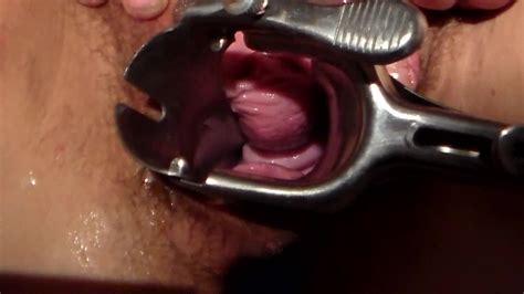 Speculum Bizarre Porn At ThisVid Tube Speculum Bizarre Porn At ThisVid Tube