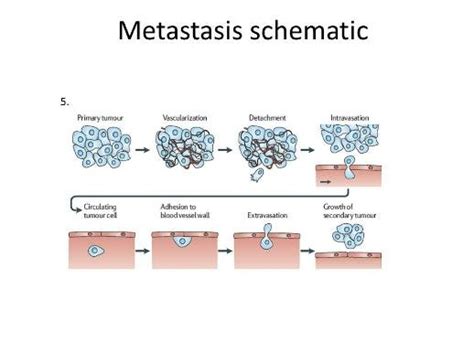 A Schematic Diagram Of The Metastasis Process Which Involves Cells