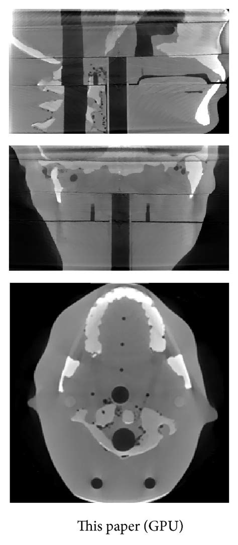 The Reconstructions Of Real Ct Data Experiments The First Second And Download Scientific