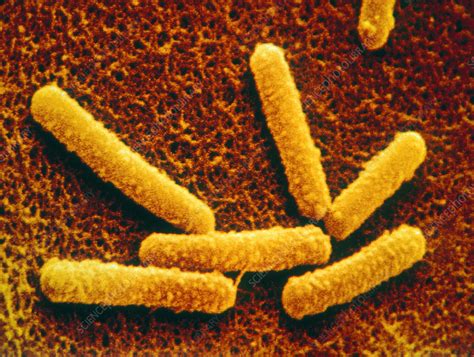 Coloured Sem Of Bacillus Subtilis Stock Image B220 0597 Science Photo Library