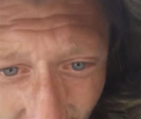 Why Does He Have Pinpoint Pupils Rdaniellarson