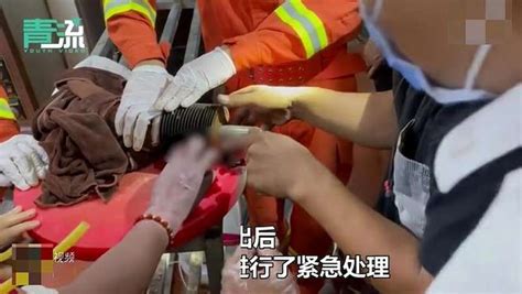看着都疼！安徽一餐厅女工手卡绞肉机 消防紧急拆卸解救mp4时事事故灾难好看视频