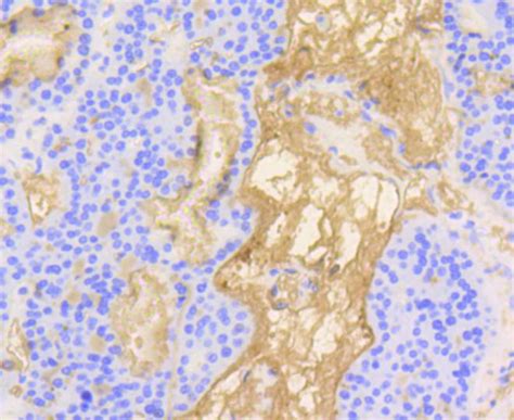 Vitronectin Recombinant Monoclonal Antibody St49 02 Ma5 32157