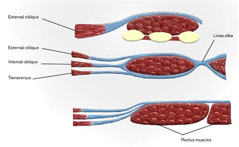 Arcuate Line Of Rectus Sheath Musculoskeletal Sources Of Abdominal And