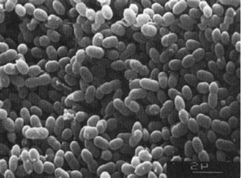 Streptococcus Lactis Microscopic