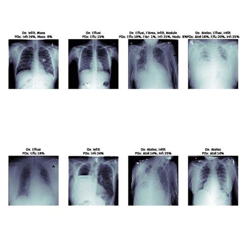 Pdf Deep Learning Approach For Automatic Classification Of X Ray Images Using Convolutional