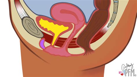 The Link Between Constipation And Urinary Leakage How To Improve Bowel