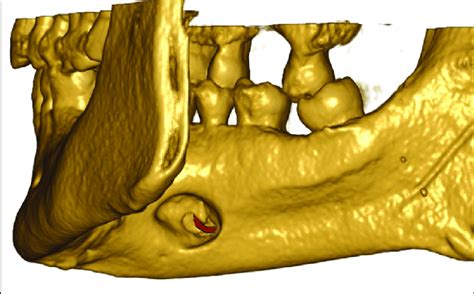 Three Dimensional Cone Beam Computed Tomography Volume Rendering Download Scientific Diagram