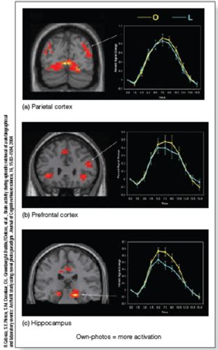 Flashcards Advanced Neuropsychology Quizlet
