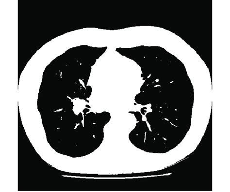 Image After Otsu Based Binarization Download Scientific Diagram