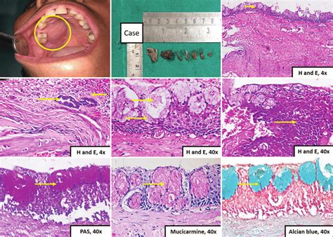 A Clinical Examination Showing A Diffuse Solitary Nodular Swelling 4