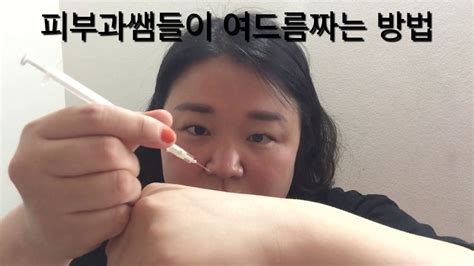 피부과쌤들이 여드름짜는 방법 Youtube