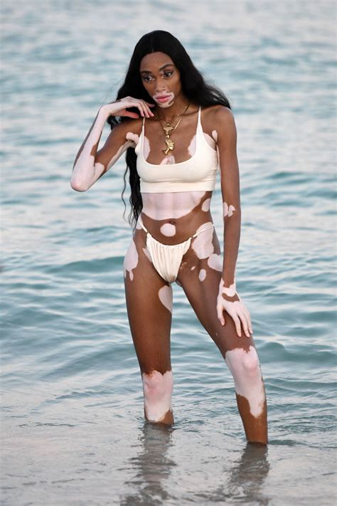 74 Best Winnie Harlow Images On Pholder Winnieharlow Antm And Pics