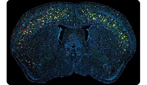 β Amyloid Transgenic Models Of Alzheimers Disease Appps1 Models