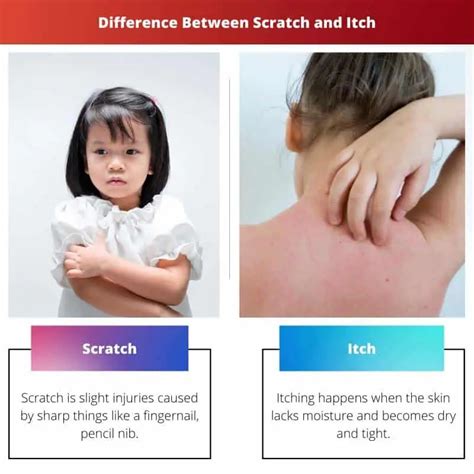 Scratch Vs Itch Difference And Comparison