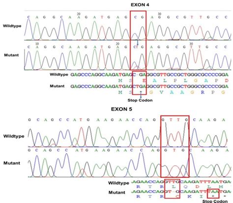 Runx1基因突变与印尼aml患者生存预后及白细胞动态变化的队列研究 生物通