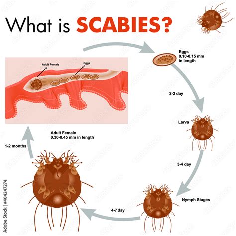 Scabies Life Cycle