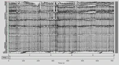 Intro To EEG Data Analysis RK
