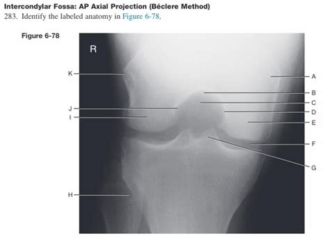 Diagram Of Intercondylar Fossa Ap Quizlet