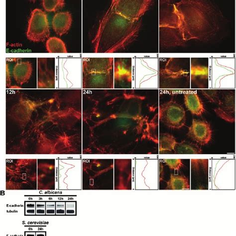 E Cadherin Mediated Cellcell Adhesions Were Affected Differentially By Download Scientific