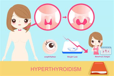 170 Goiter Cartoons Stock Illustrations Royalty Free Vector Graphics