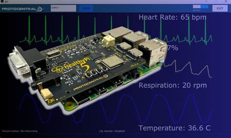 Healthypi 5 Plataforma De Aquisição De Biosinais Embarcados Healthypi 5 Plataforma De Aquisição De Biosinais Embarcados