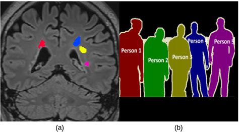 Instance Level Quantitative Saliency In Multiple Sclerosis Lesion