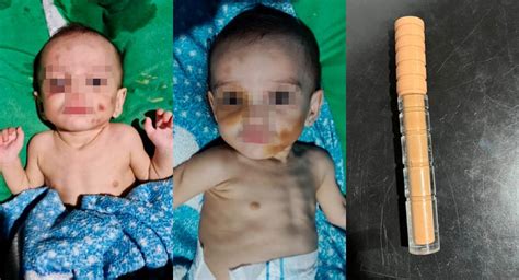 Juiz Solta Mãe Que Confessou Espancar Filha De 1 Ano Em Veramt